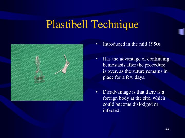 PPT - Neonatal Circumcision PowerPoint Presentation - ID:262163