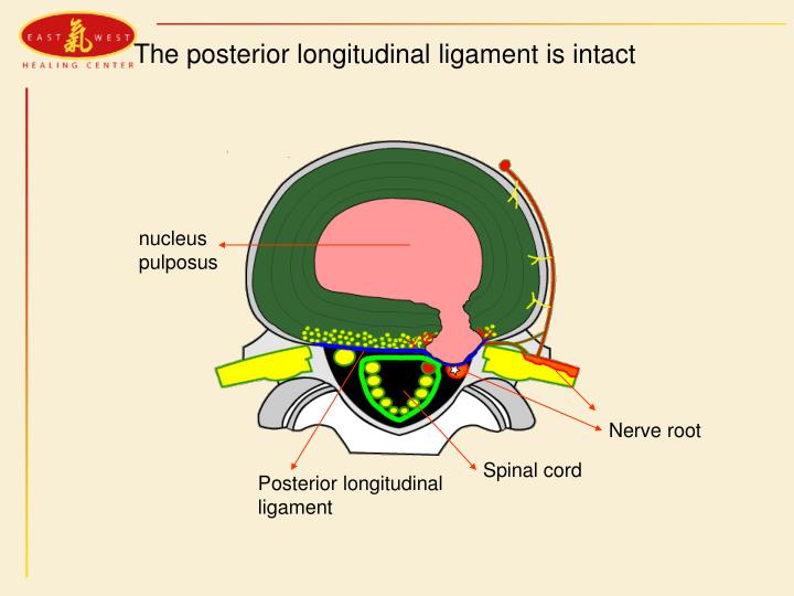 PPT - Pathology and TCM Treatment of the Herniated Lumbar Disc ...