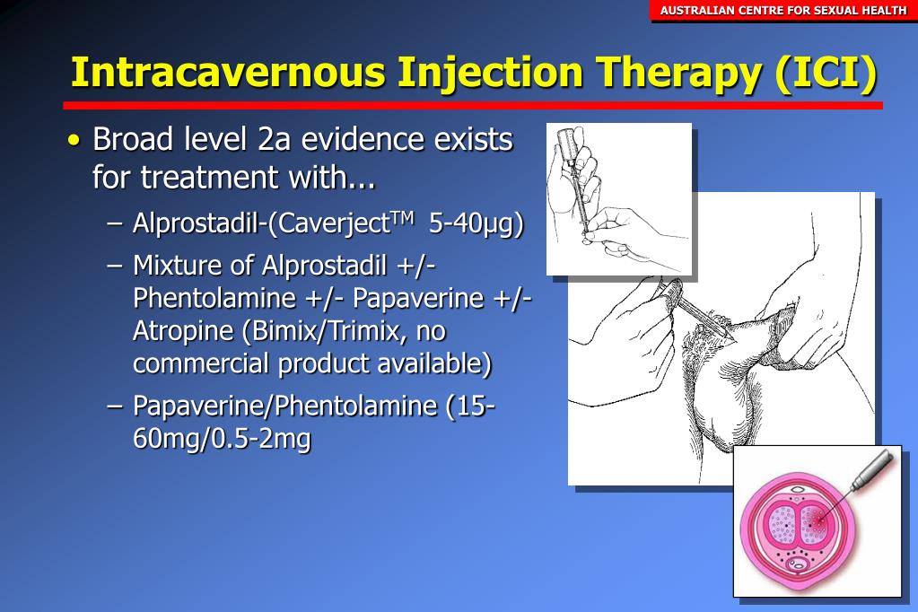 PPT - Update on the Management of Erectile Dysfunction & Premature ...