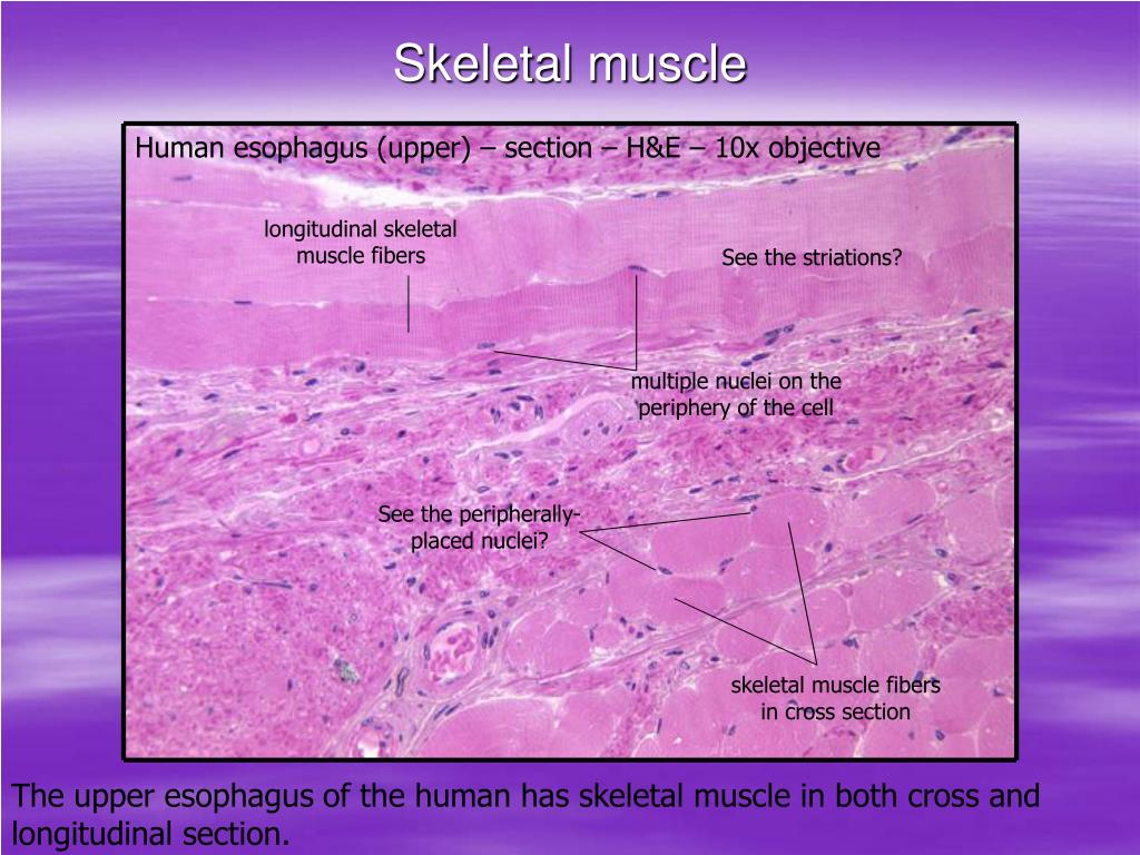 Skeletal Muscle Slide Labeled