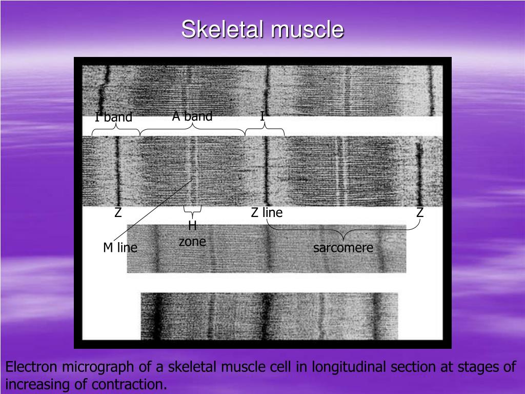 PPT - BIO 240 HISTOLOGY REVIEW Muscle Tissue PowerPoint Presentation ...