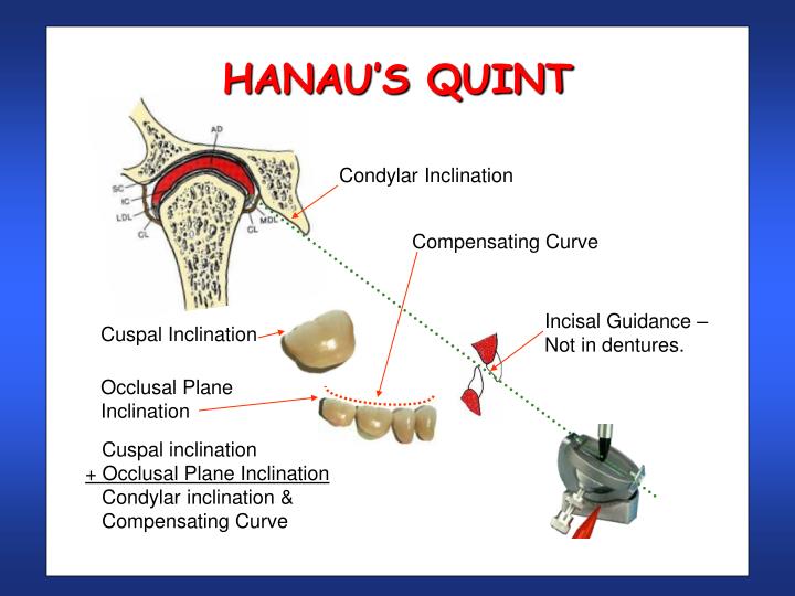 PPT - Setting Anatomic Teeth PowerPoint Presentation - ID:265221