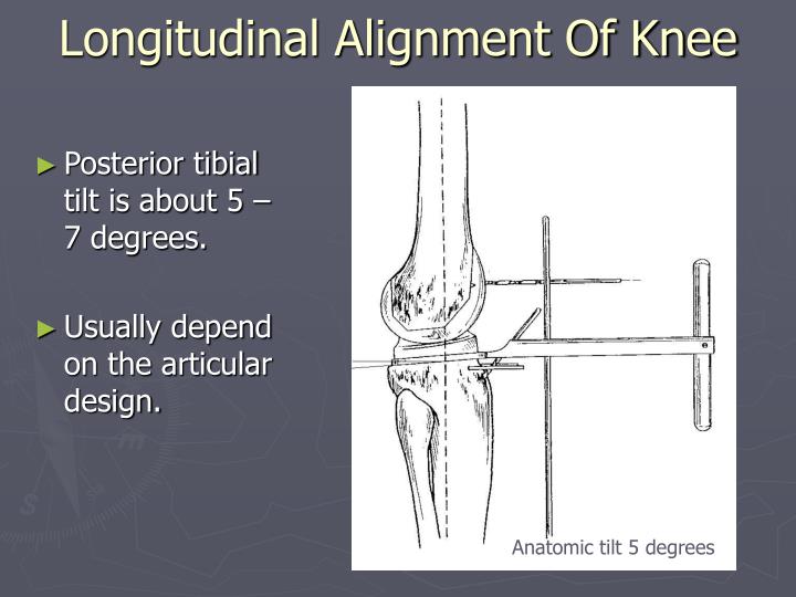 PPT - Total Knee Arthroplasty PowerPoint Presentation - ID:265534