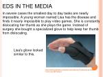 PPT - EHLERS-DANLOS SYNDROME PowerPoint Presentation - ID:266473
