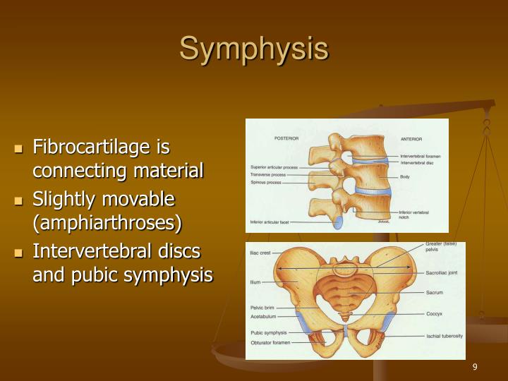PPT - Chapter 9 Joints PowerPoint Presentation - ID:266616