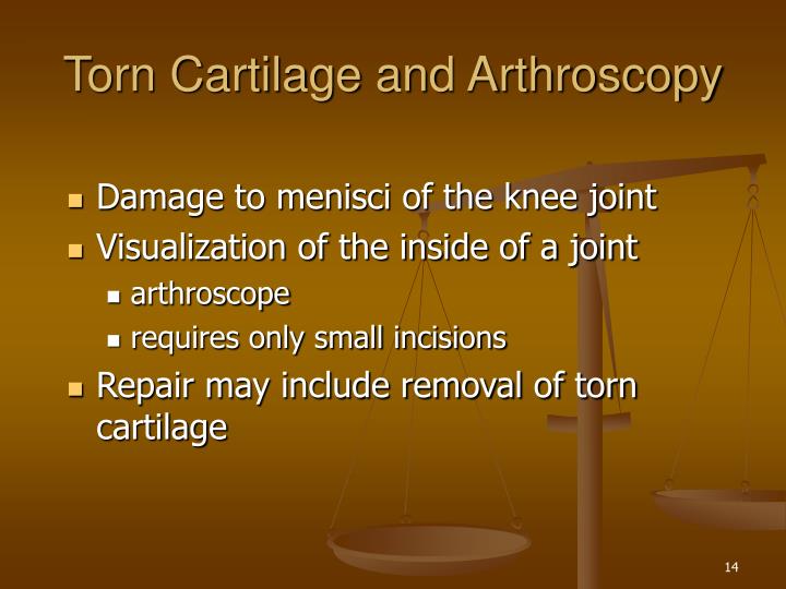 PPT - Chapter 9 Joints PowerPoint Presentation - ID:266616