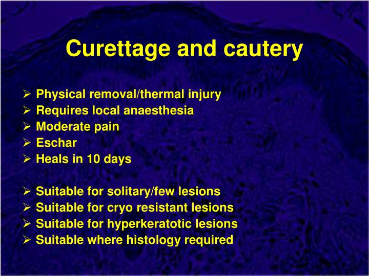 PPT - Actinic Keratosis PowerPoint Presentation - ID:267331