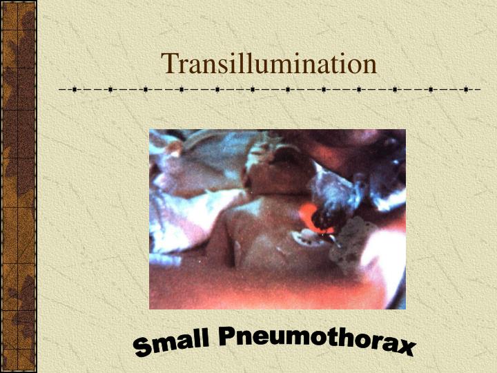 PPT - Neonatal Diseases PowerPoint Presentation - ID:268925