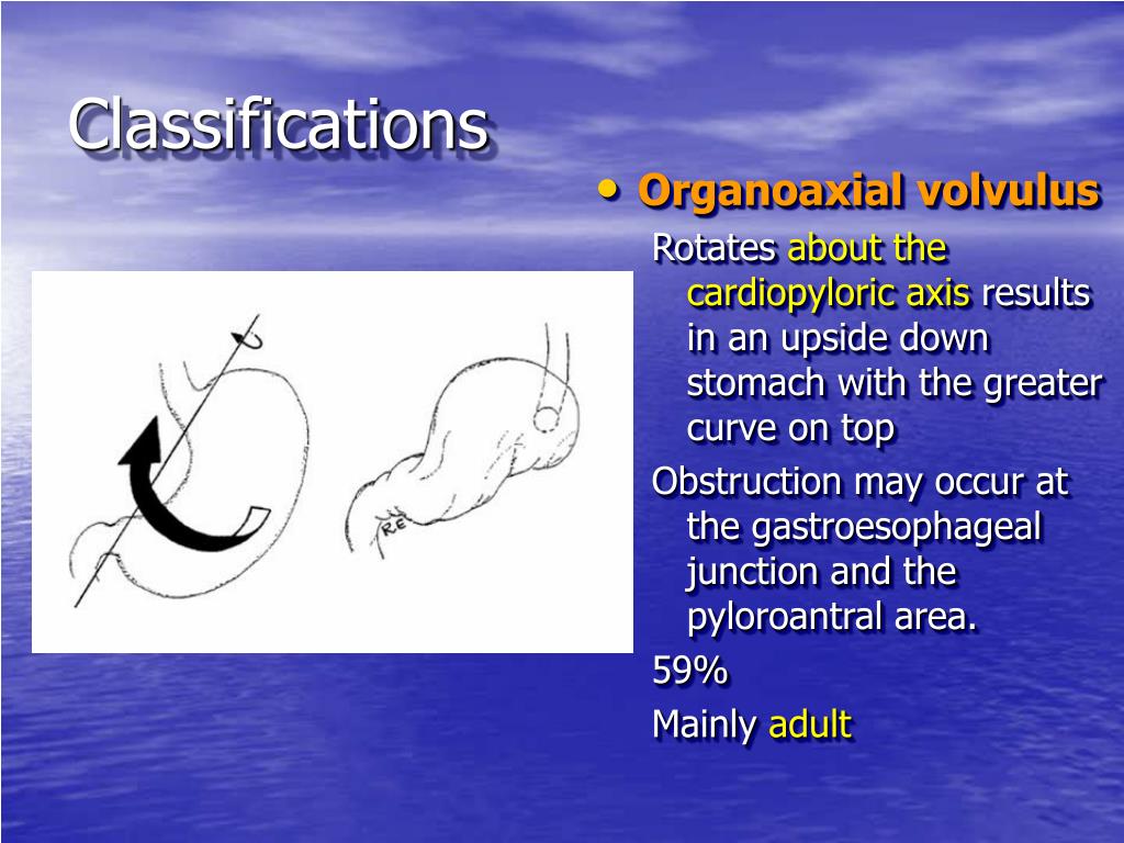 PPT - Joint Hospital Grand Round Management of Chronic Gastric Volvulus ...