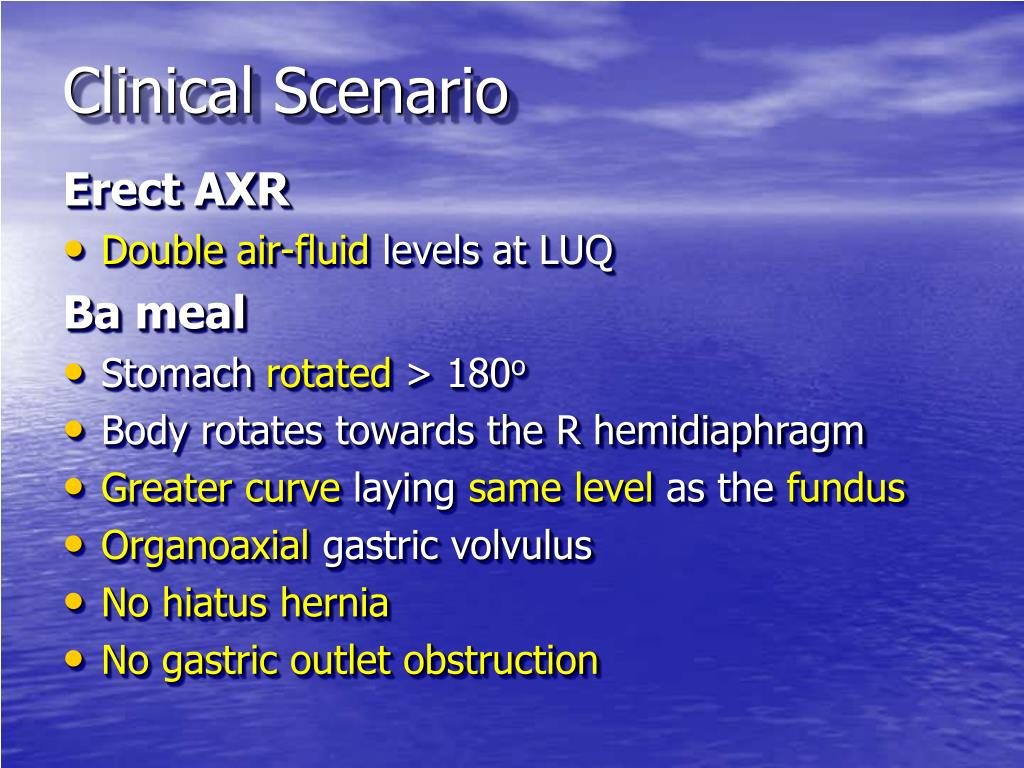 PPT - Joint Hospital Grand Round Management of Chronic Gastric Volvulus ...