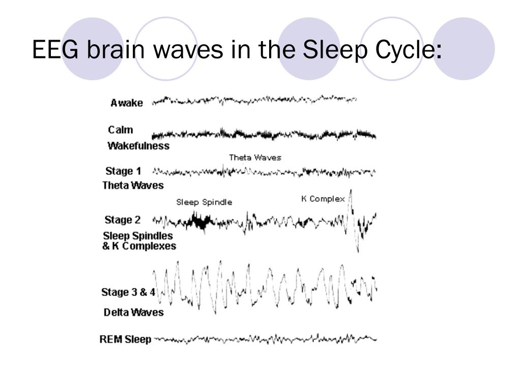 PPT - Electroencephalogram (EEG): Measuring Brain Waves PowerPoint ... PPT - Electroencephalogram (EEG): Measuring Brain Waves PowerPoint ...