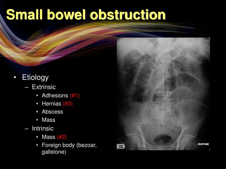 PPT - Small Bowel PowerPoint Presentation - ID:272078