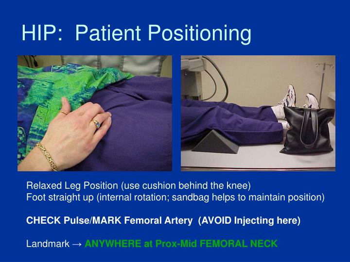 PPT - Basic Joint Injection “How to do it” PowerPoint Presentation - ID ...