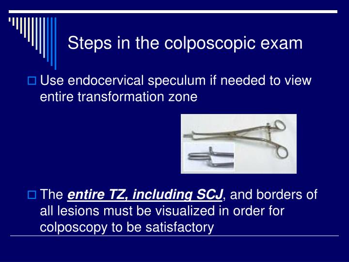 PPT - Colposcopy PowerPoint Presentation - ID:275680