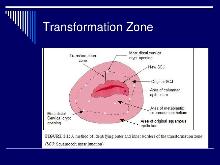 PPT - Colposcopy PowerPoint Presentation - ID:275680
