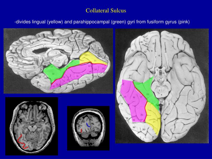 PPT - A Neuroanatomy primer. PowerPoint Presentation - ID:276433