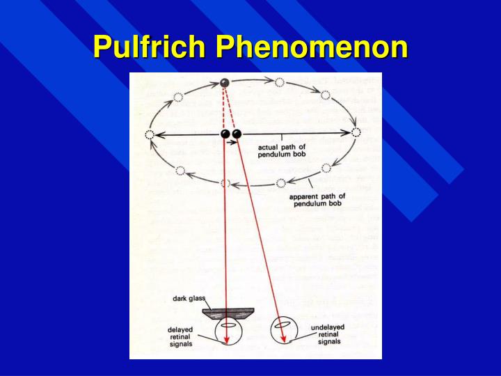 PPT - The Neuro-Ophthalmology of Multiple Sclerosis Charles Maxner MD ...