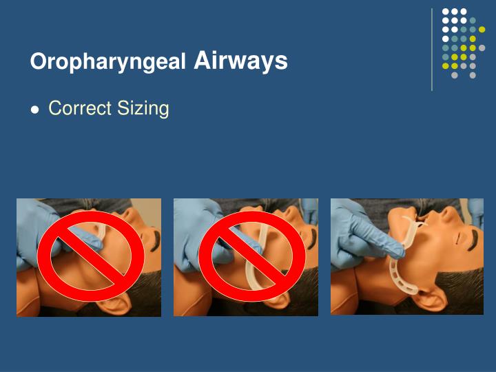 PPT - Airway Management Part I PowerPoint Presentation - ID:279323