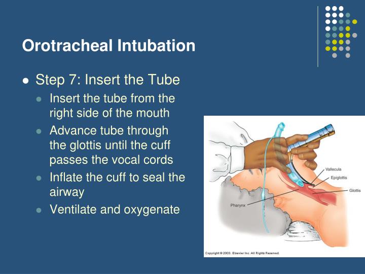 PPT - Airway Management Part I PowerPoint Presentation - ID:279323