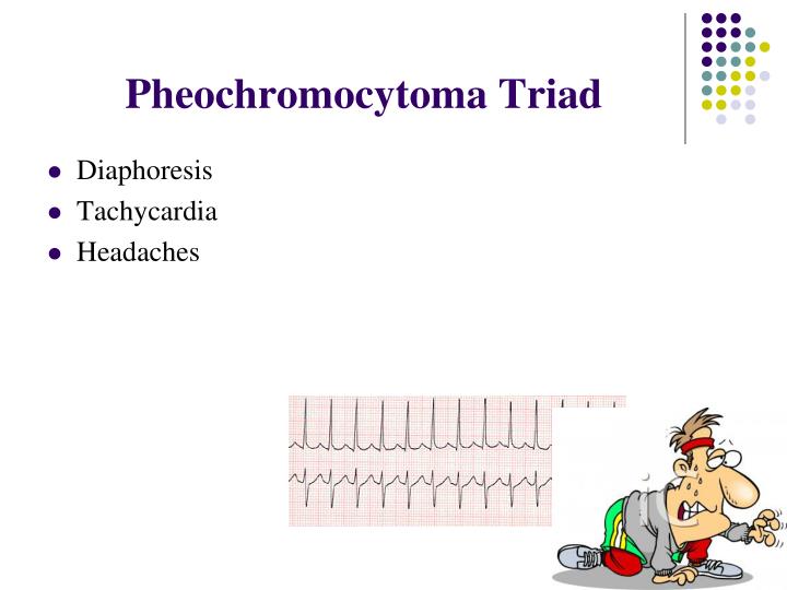 PPT - Pheochromocytoma PowerPoint Presentation - ID:280727