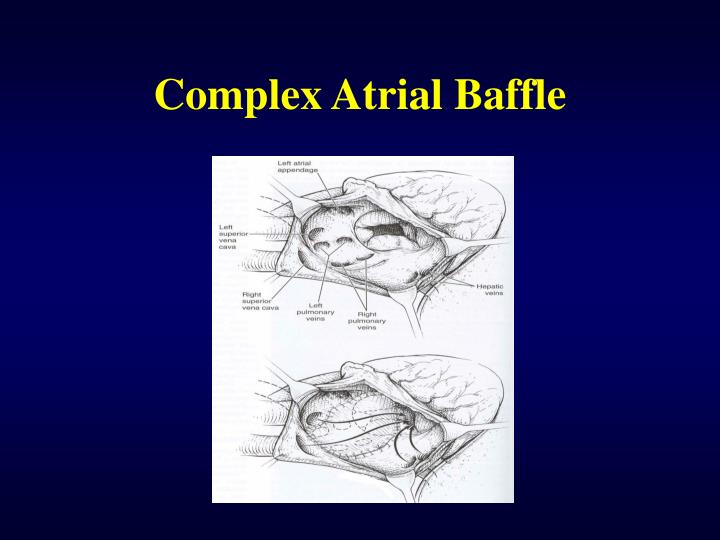 PPT - Double Inlet Ventricle PowerPoint Presentation - ID:282508