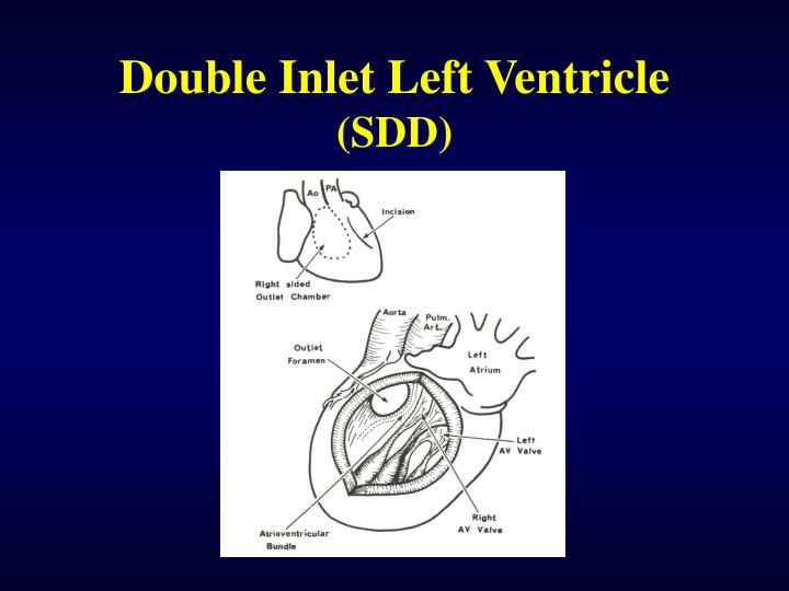 PPT - Double Inlet Ventricle PowerPoint Presentation - ID:282508