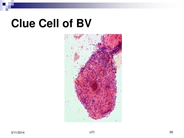 PPT - Laboratory Diagnosis of Urinary Tract Infections PowerPoint ...