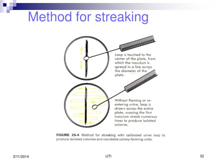 PPT - Laboratory Diagnosis of Urinary Tract Infections PowerPoint ...
