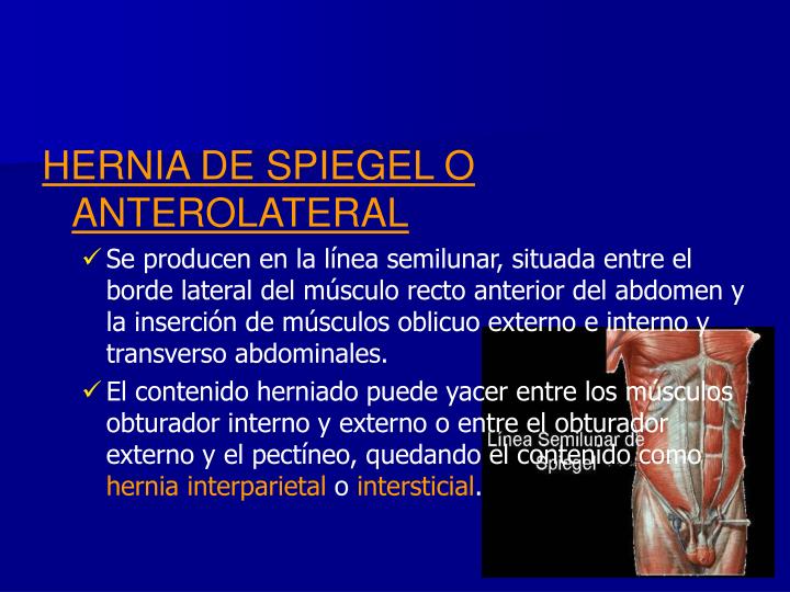 PPT - Patología herniaria de la pared abdominal, del concepto a la ...