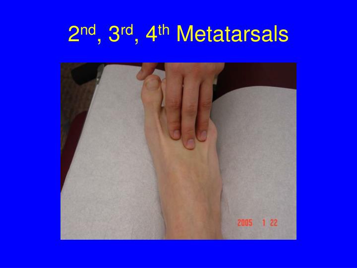 PPT - Foot Surface Anatomy PowerPoint Presentation - ID:288077