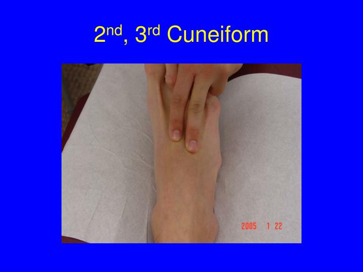 PPT - Foot Surface Anatomy PowerPoint Presentation - ID:288077