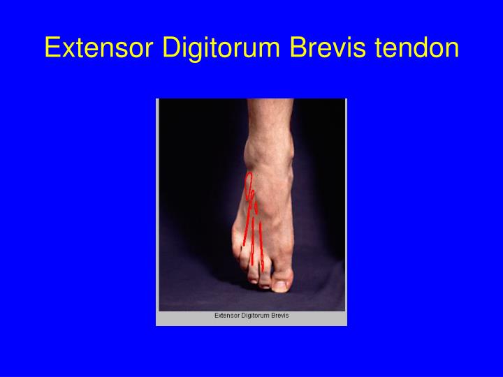 PPT - Foot Surface Anatomy PowerPoint Presentation - ID:288077