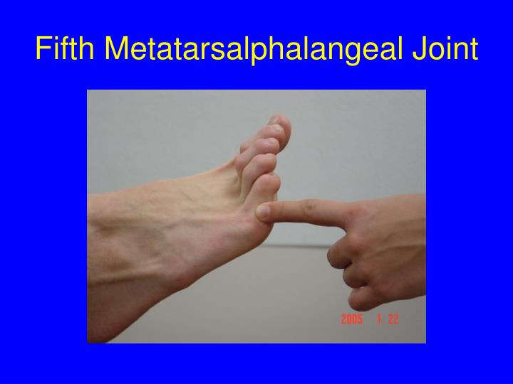 PPT - Foot Surface Anatomy PowerPoint Presentation - ID:288077