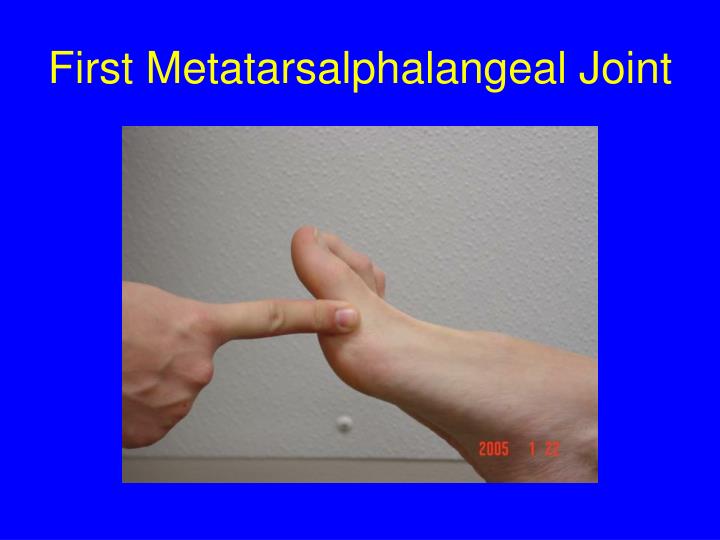 PPT - Foot Surface Anatomy PowerPoint Presentation - ID:288077