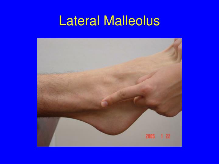 PPT - Foot Surface Anatomy PowerPoint Presentation - ID:288077