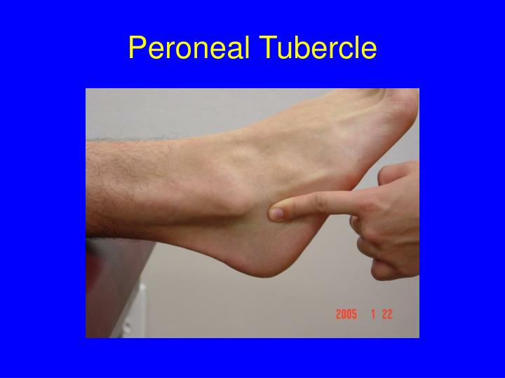 PPT - Foot Surface Anatomy PowerPoint Presentation - ID:288077