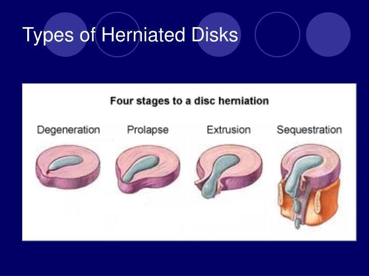 PPT - CERVICAL SPINE INJURIES PowerPoint Presentation - ID:289834