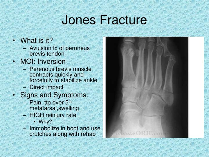 PPT - FOOT, ANKLE AND LOWER LEG PowerPoint Presentation - ID:289973