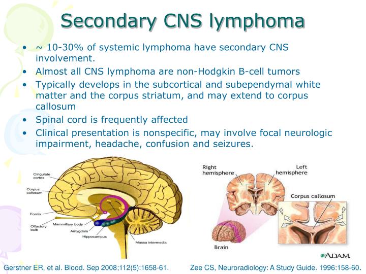 PPT - Phenytoin VS levetiracetam for seizure prophylaxis in secondary ...