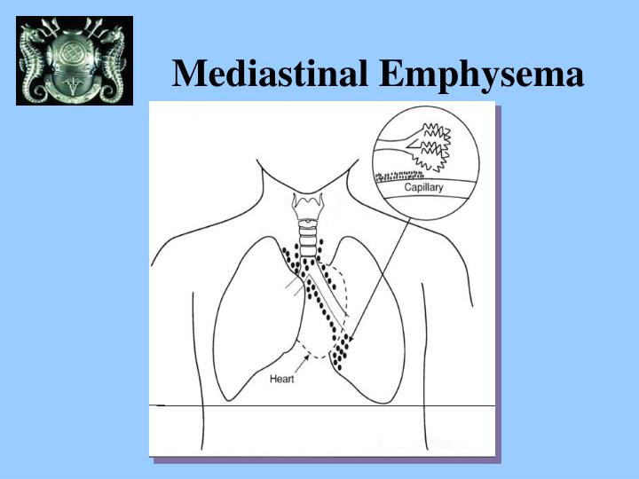PPT - Diving Medicine: An Overview PowerPoint Presentation - ID:290702