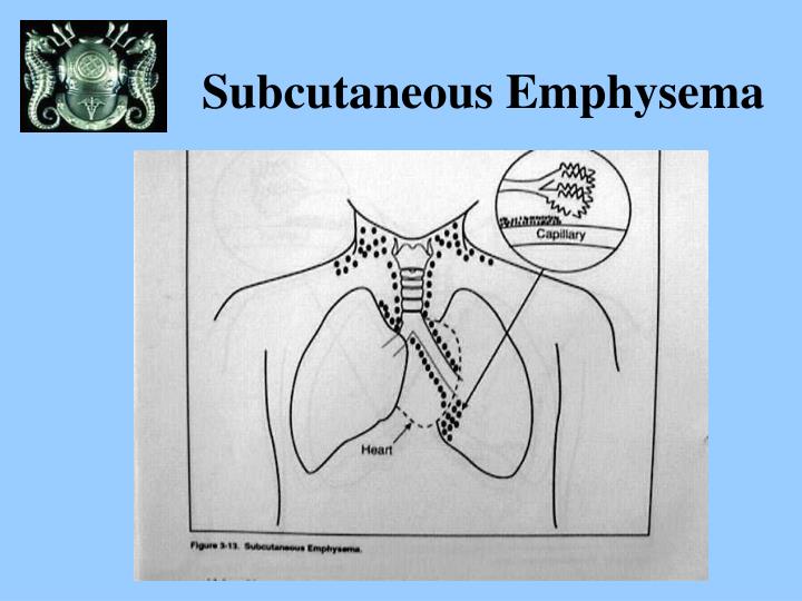 PPT - Diving Medicine: An Overview PowerPoint Presentation - ID:290702