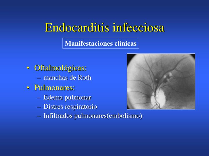 PPT - Valvulopatías .Etiología,Endocarditis Infecciosa y Fiebre ...