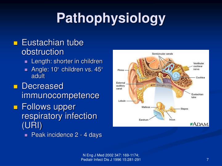 PPT - Acute Otitis Media PowerPoint Presentation - ID:291914