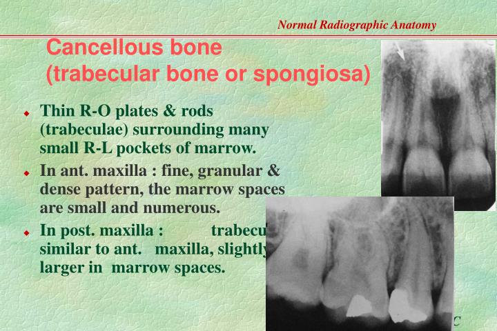 PPT - Normal Radiographic Anatomy- Based on Intraoral Films PowerPoint ...