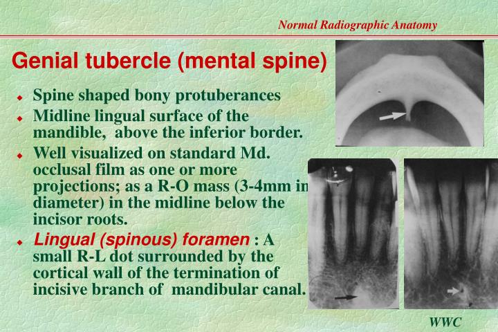 PPT - Normal Radiographic Anatomy- Based on Intraoral Films PowerPoint ...
