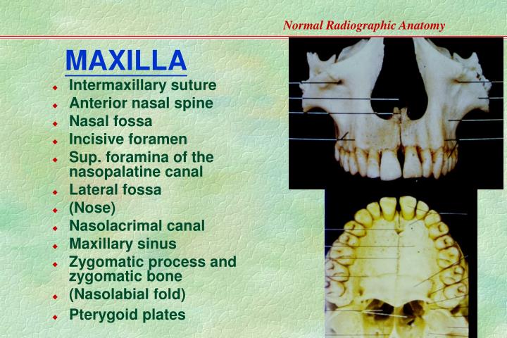 PPT - Normal Radiographic Anatomy- Based on Intraoral Films PowerPoint ...