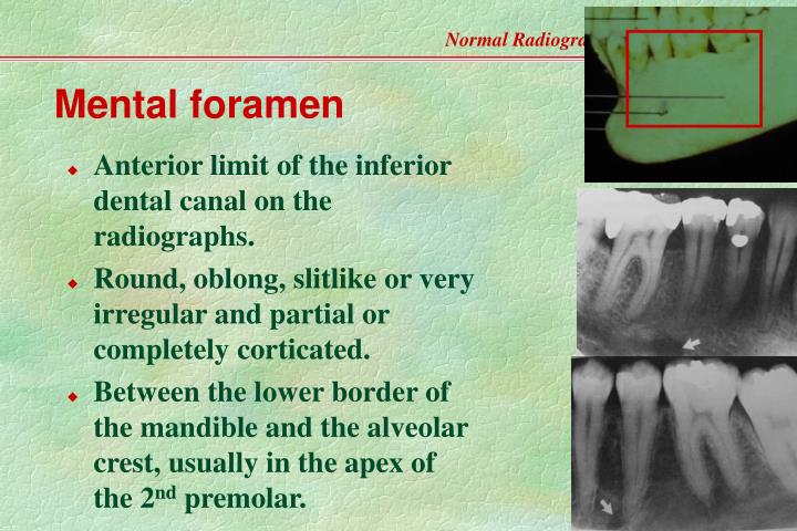 PPT - Normal Radiographic Anatomy- Based on Intraoral Films PowerPoint ...
