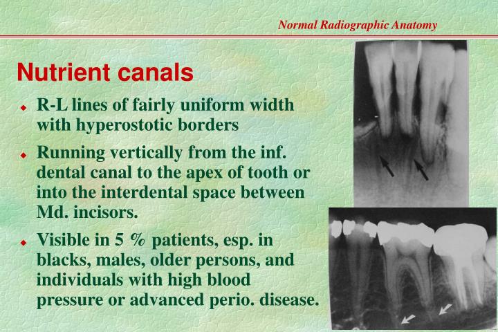 PPT - Normal Radiographic Anatomy- Based on Intraoral Films PowerPoint Presentation - ID:292169