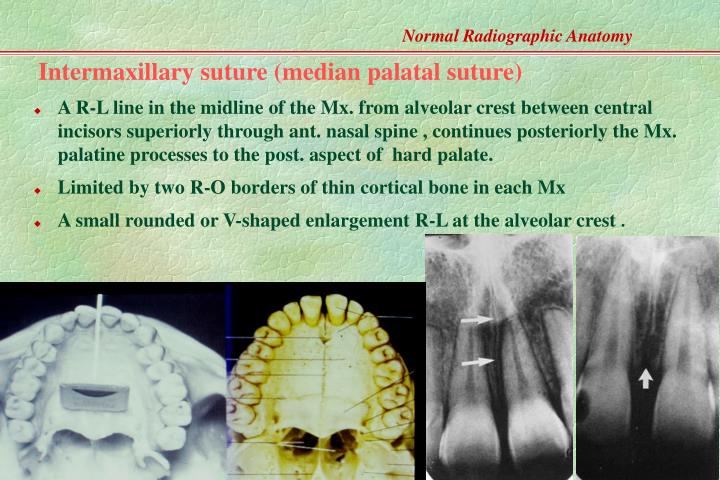 PPT - Normal Radiographic Anatomy- Based on Intraoral Films PowerPoint ...