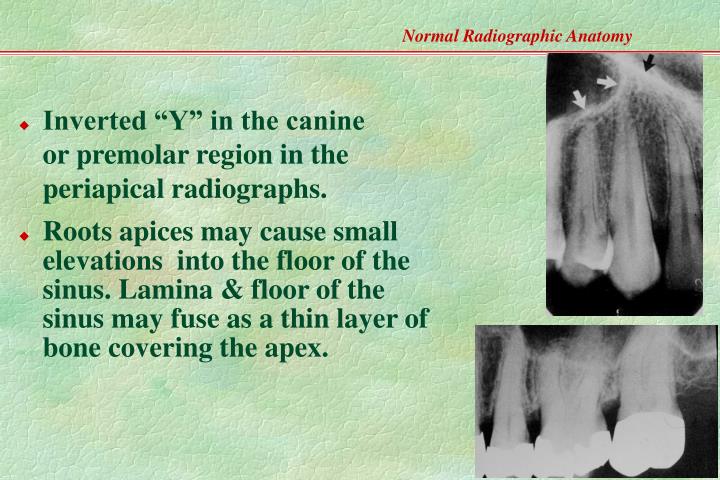 PPT - Normal Radiographic Anatomy- Based on Intraoral Films PowerPoint ...